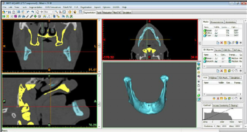 کلینیک تخصصی نرم افزار میمیکس (mimics)